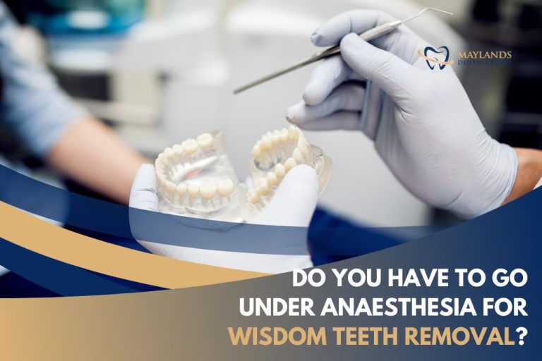 Do You Have to Go Under Anaesthesia for Wisdom Teeth Removal ...