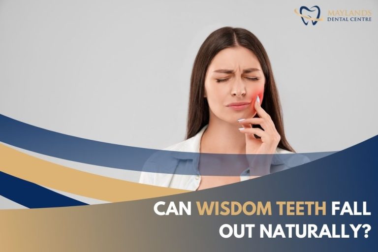 Can Wisdom Teeth Fall Out Naturally? - Maylands Dental Centre