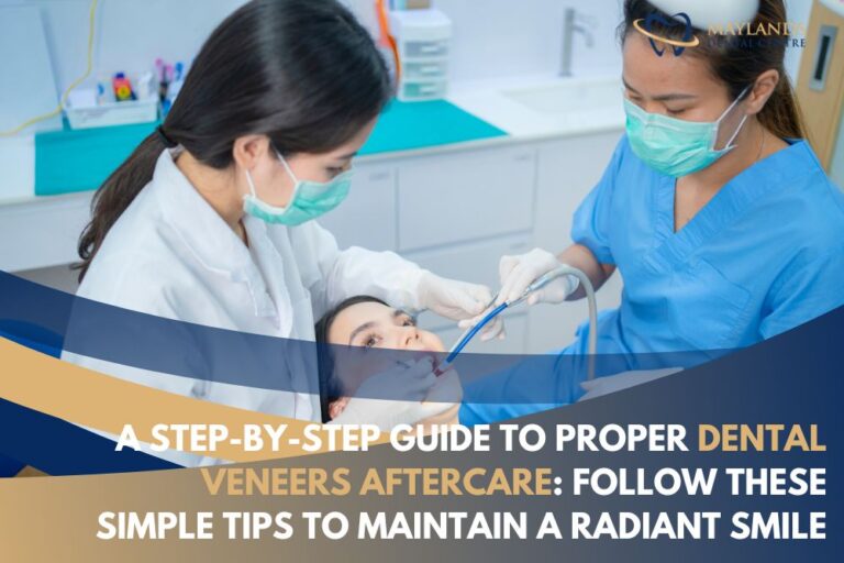 A Step-by-Step Guide to Proper Dental Veneers Aftercare: Follow These ...