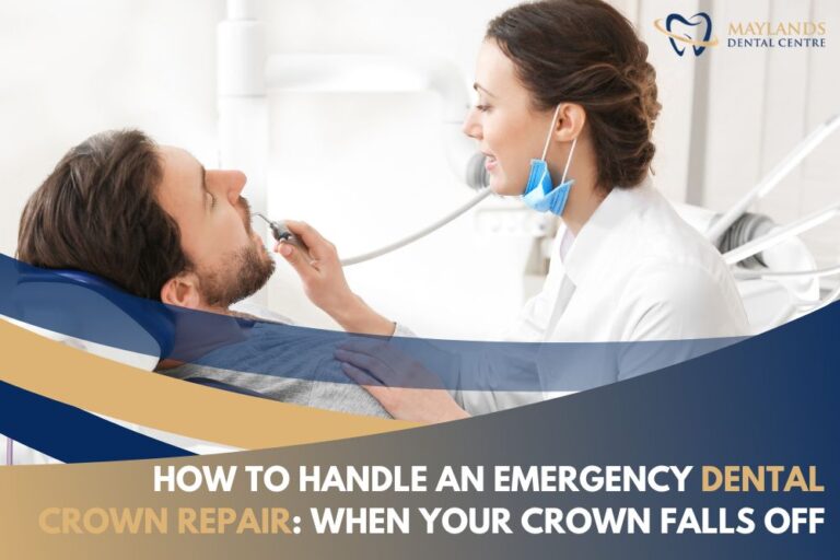 How to Handle an Emergency Dental Crown Repair: When Your Crown Falls ...
