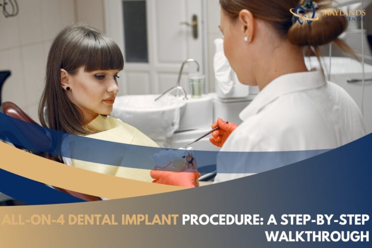 All-on-X Dental Implant Procedure: A Step-by-Step Walkthrough ...