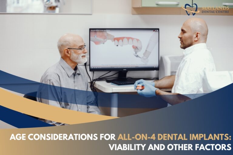 Age Considerations for All-On-4 Dental Implants: Viability and Other ...