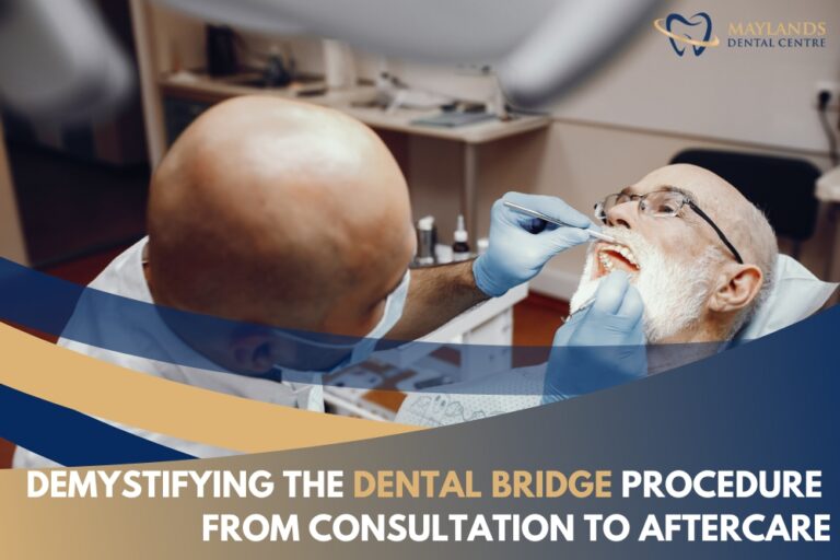 Demystifying the Dental Bridge Procedure From Consultation to Aftercare ...