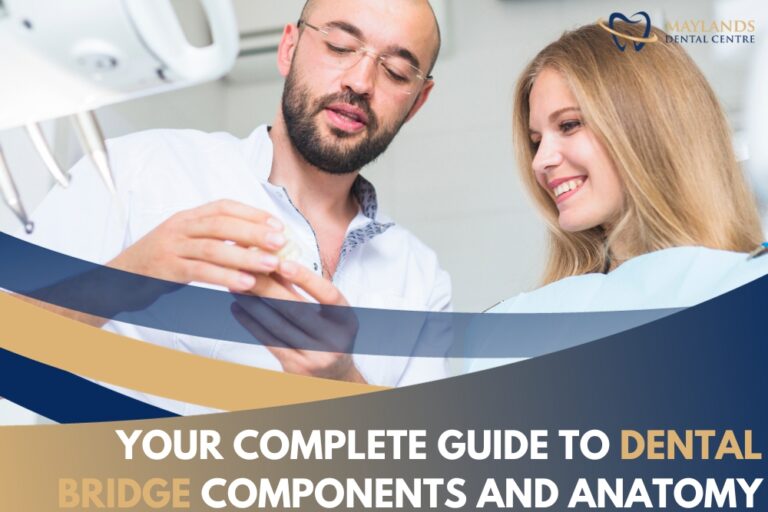 Your Complete Guide to Dental Bridge Components and Anatomy - Maylands ...