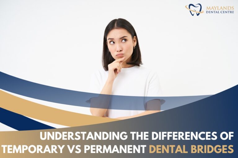 Understanding the Differences of Temporary vs Permanent Dental Bridges ...