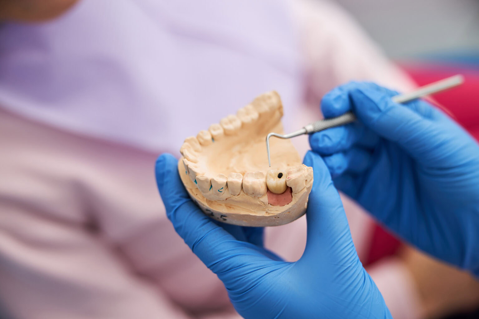 Smile Confidently by Managing Dental Crown Complications - Maylands ...