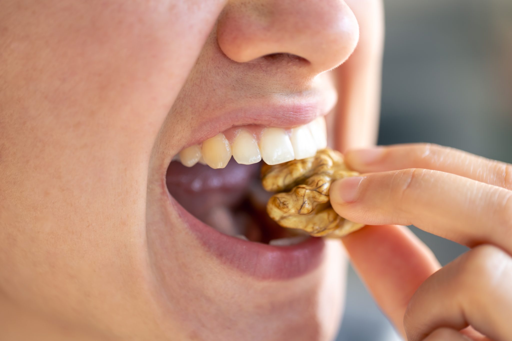 What Is the Colour of Unhealthy Gums? - Maylands Dental Centre